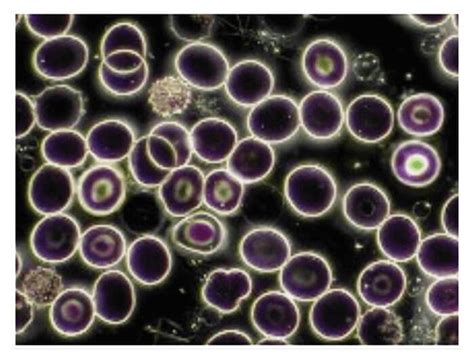 Dark Field Microscopy Bacteria