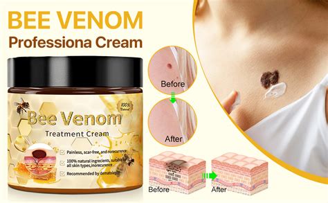 Bee Venom Treatment Cream Bee Venom Skin Treatment Cream Natural Bee