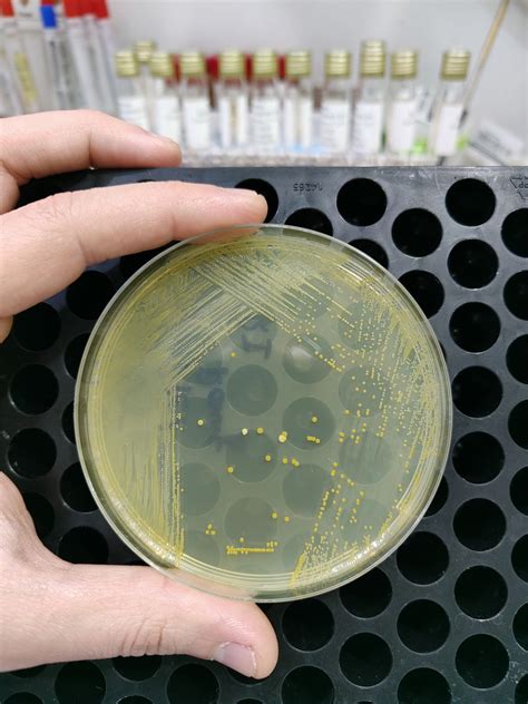 Enterococcus Faecalis Sur Milieu Cled Achraf Kara Mohammed 🇩🇿