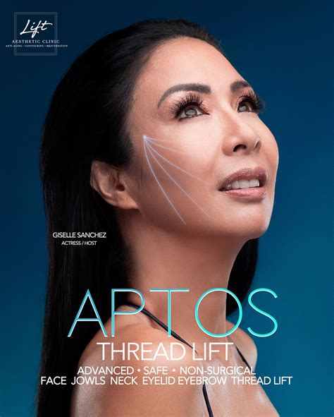 Lift A Beautiful Aptos Thread Lift Done By Dr Cyril Agan To Actress