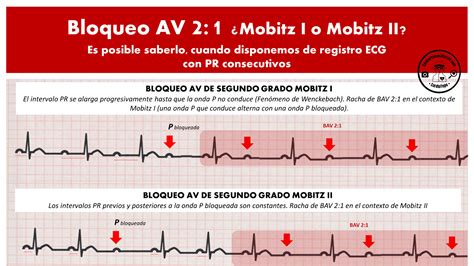 Cardiotrucos Archivos Página 3 De 5 Cardioprimaria Ferrol