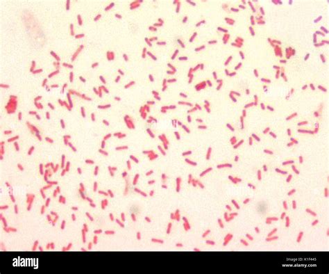 Yersinia Pestis Gram Negative Bacillus 1000x Magnification Y Pestis