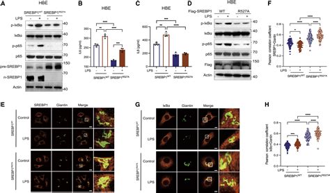 The Scap Srebp1 S1ps2p Lipogenesis Signal Orchestrates The Homeostasis