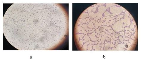 Gambar 1 A Sel Propionibacterium Acnes 10x Pada Mikroskop B Sel Download Scientific