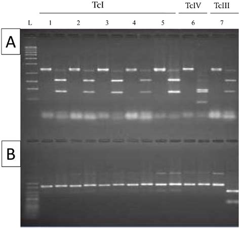 Pcr Rflp Genotyping Profiles Of Venezuelan Trypanosoma Cruzi Strains