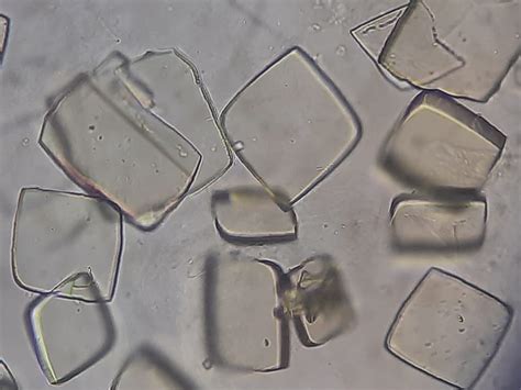 Urate Crystals Introduction Identification Features And Clinical