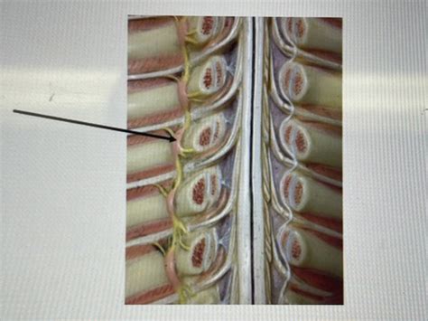 Chapter 14 Lab Flashcards Quizlet