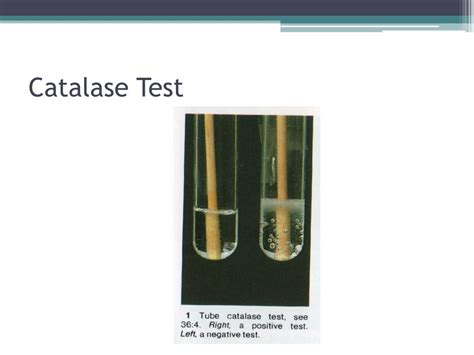 Ppt Streptococcus Species Powerpoint Presentation Free Download Id