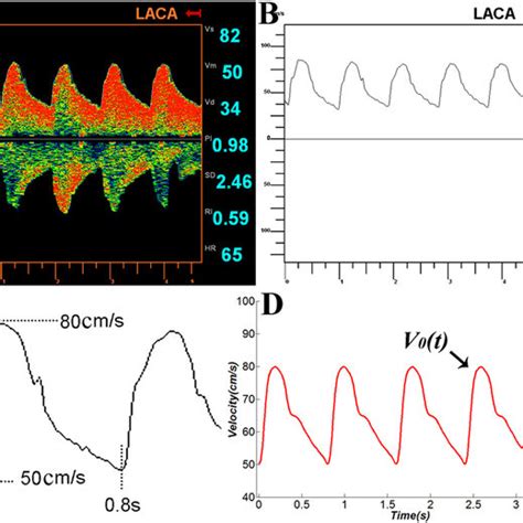 All Nine Tcd Waves Of A Patient Left Estimated Waveforms For Each Download Scientific