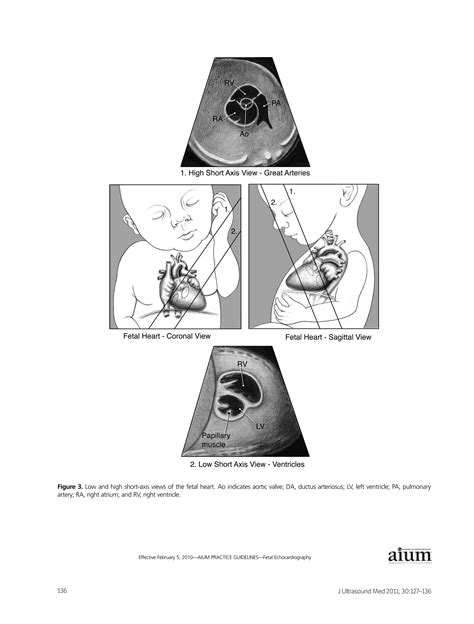Aium Practice Guideline For The Performance Of Fetal Echocardiography Pdf