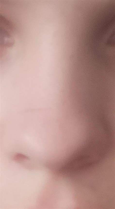 Whats My Nose R Noses