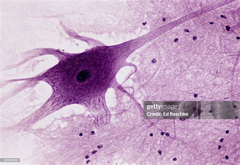 Neuroglia Microscope