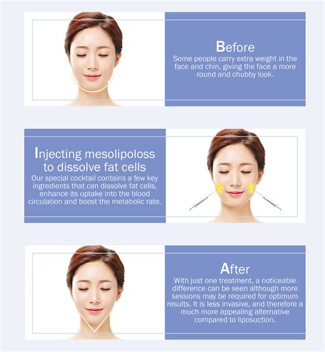 Face Slimming Clinic Rx