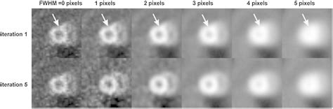 Example Images Of OSEM Reconstructed Images With One And Five Effective Download Scientific