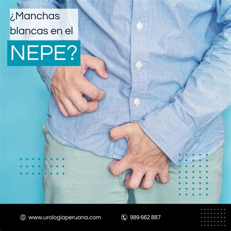 Manchas Blancas En El Pene Causas Síntomas Y Tratamiento Urología