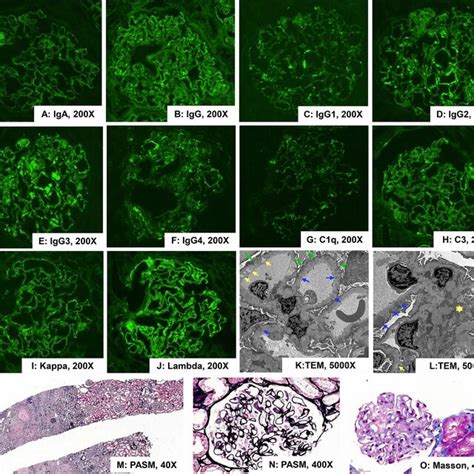 Lymph Nodes Histological Analysis By He And Ihc Staining A He