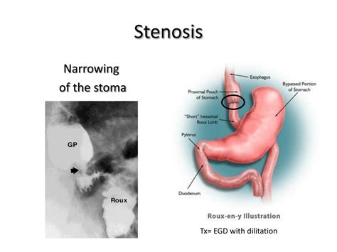 Ppt Caring For The Obese Patient Magic Valley Residency Program 2011