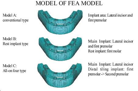 Finite Element Models Of Three Types Of Used Download Scientific Diagram