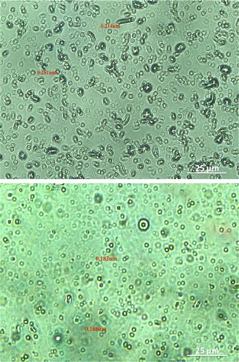 Optical Micrographs Of Control Niosomes Upper Figure And Niosomal