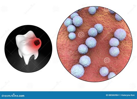 Streptococcus Mutans Bacteria Stock Illustration 78018781