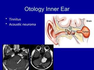 Ear Nose And Throat Introduction With Brief Explanation Pptx