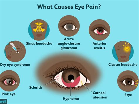 How Soon After Cataract Surgery Can I Wear Eye Makeup Saubhaya Makeup