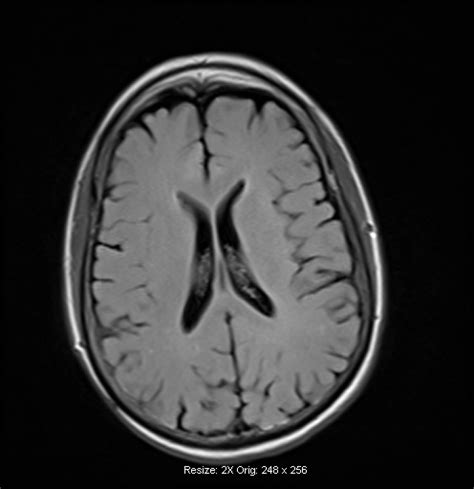 Reading The Magnetic Spatial Gradient Map Rite Advantage