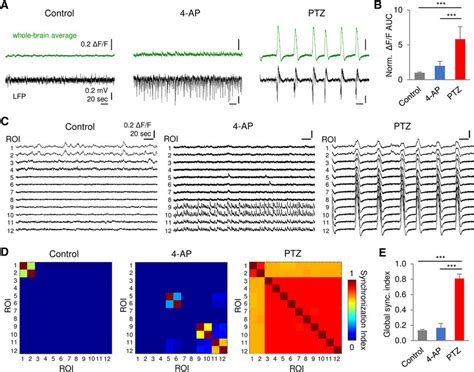 Brain Wide Network Synchronization A Representative Whole Brain