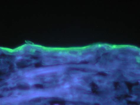 Fluorescence Microscopy Microtrace