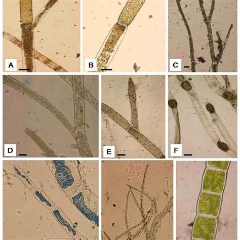 Line Drawings Of A Enteromorpha Gujratensis B C Cladophora