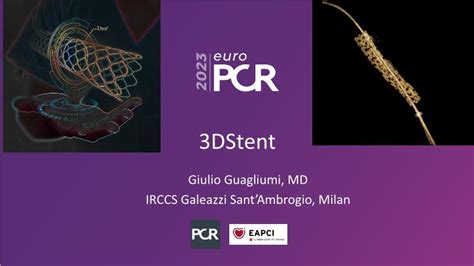 3dstent A New Era In Stent Enhancement