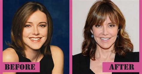 Revealing Christa Miller Plastic Surgery Before And After