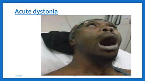 Extra Pyramidal Side Effects Pptx