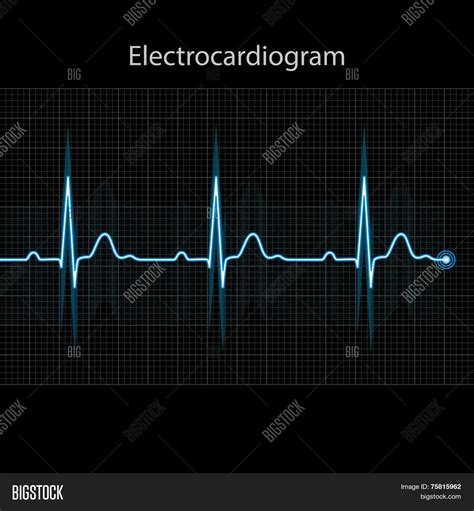Electrocardiogram 2d Vector And Photo Free Trial Bigstock