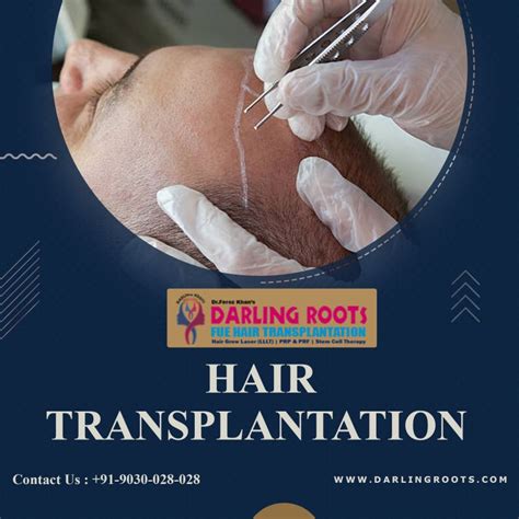 Drferoz Khan On Linkedin Hairtransplantation