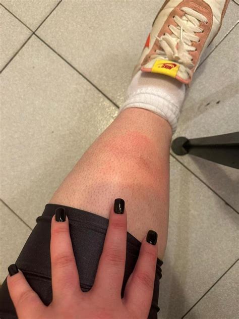 ההצגה חייבת להימשך התקרית הכואבת של שמחה גואטה על הבמה Tmi