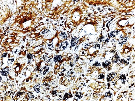 Stomach Infection By Helicobacter Heilmannii In The Gastric Mucosa Download Scientific