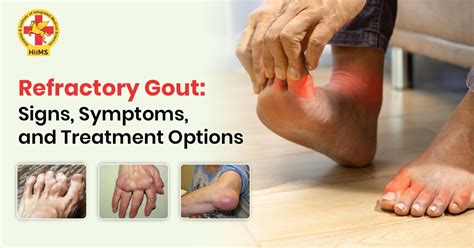 What Is Refractory Gout Disease Causes Symptoms And Care