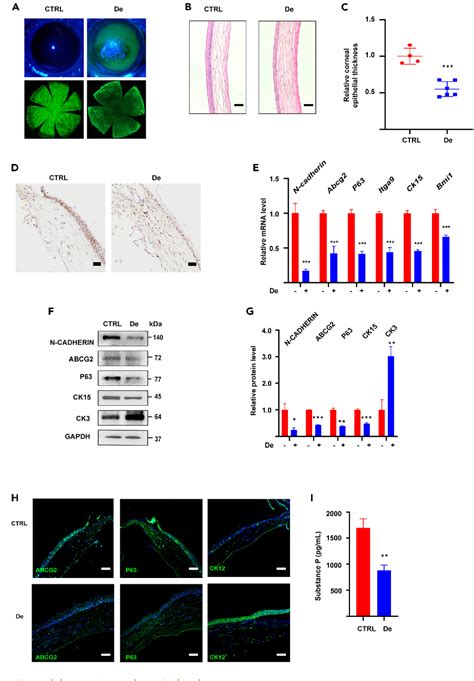 Figure 1 From Trigeminal Nerve Derived Substance P Regulates Limbal