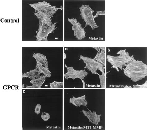 Inactivation Of Metastin By Mmp Hela Cells Cotransfected With Gfp And