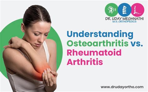 Understanding Osteoarthritis Vs Rheumatoid Arthritis