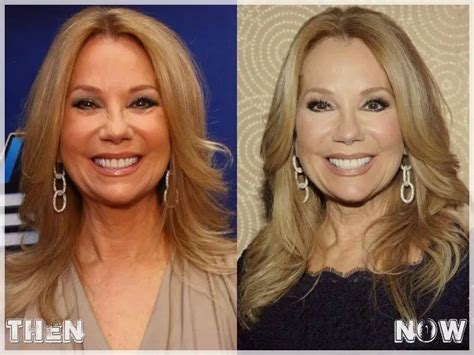 Kathie Lee Ford And Plastic Surgery Clearing The Rumours Bizrahmed