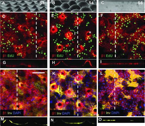 Topography Induced Patterning Of Stem Cells Differentiating Cells And