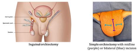 Orchiectomy Mesityl Oxide