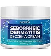Pureskin Seborrheic Dermatitis Cream Ketoconazole