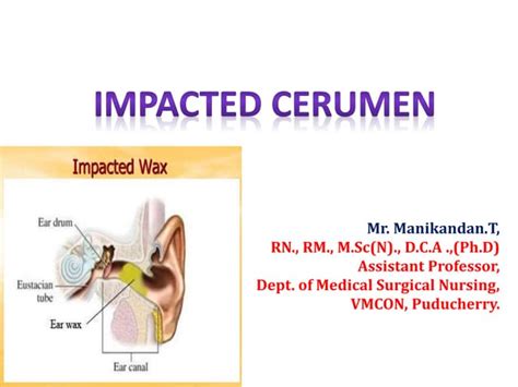 Impacted Cerumen Ppt