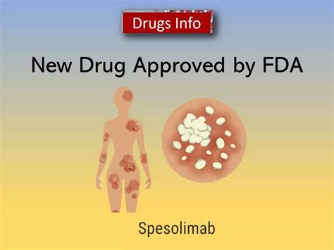 Drugsinfo New Drug Approved By Fda Spesolimab Follow Facebook