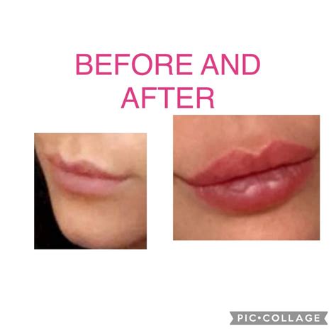 Pdo Threads For Lips What 3 Years Of Pdo Threads Have Done For My