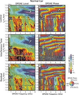 Dpoae L P Maps [ A F ] Measured At L 1 L 2 65 Db Spl