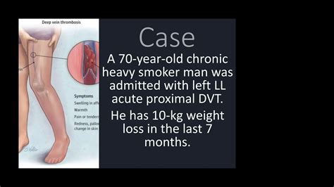 Immune Labs Basics Part 1 Acute Phase Reactants Esr Crp Ahmed Yehia